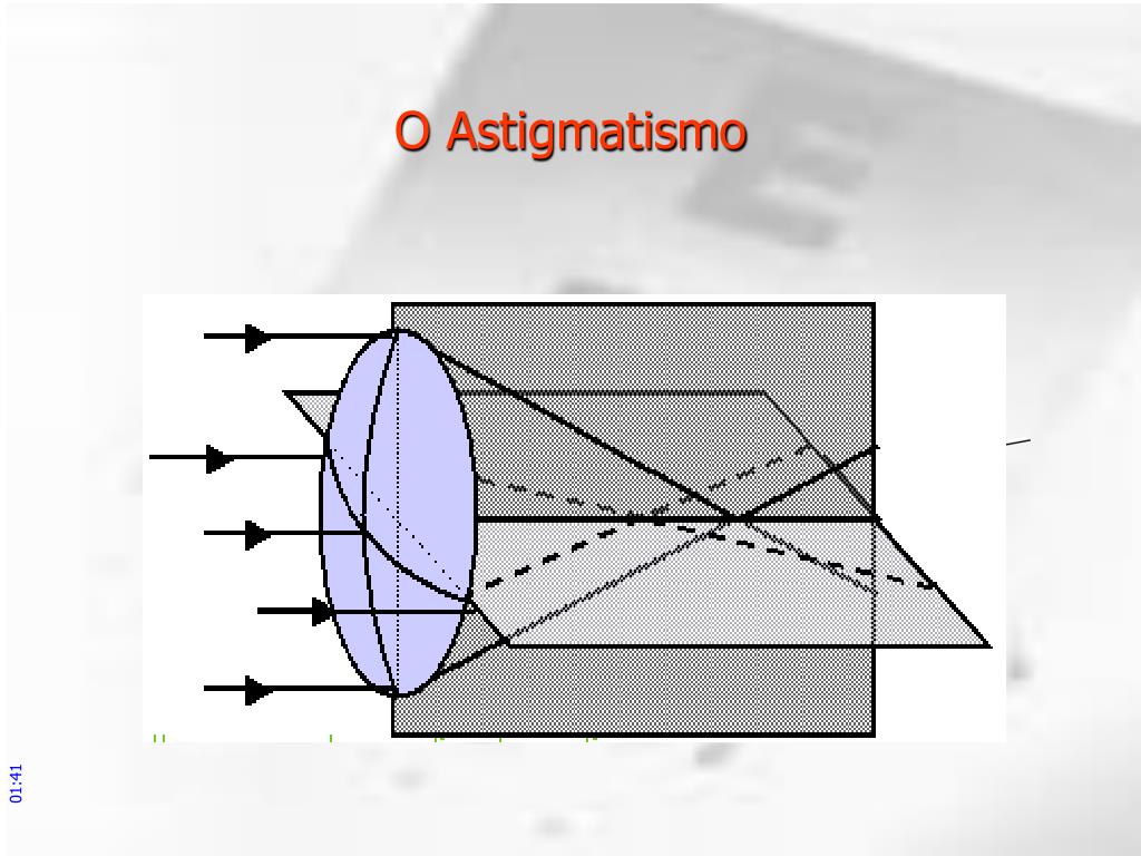PPT - Princípio s da Retinoscopia e Função de Correção dos Vícios de ...