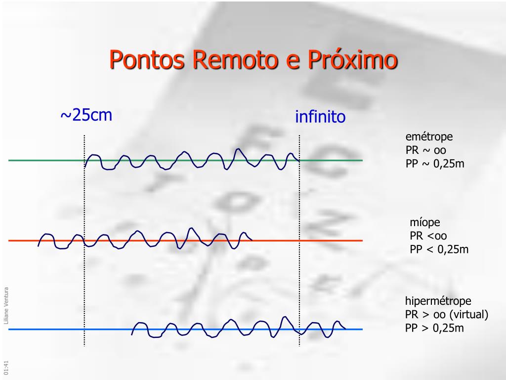 PPT - Princípio s da Retinoscopia e Função de Correção dos Vícios de ...