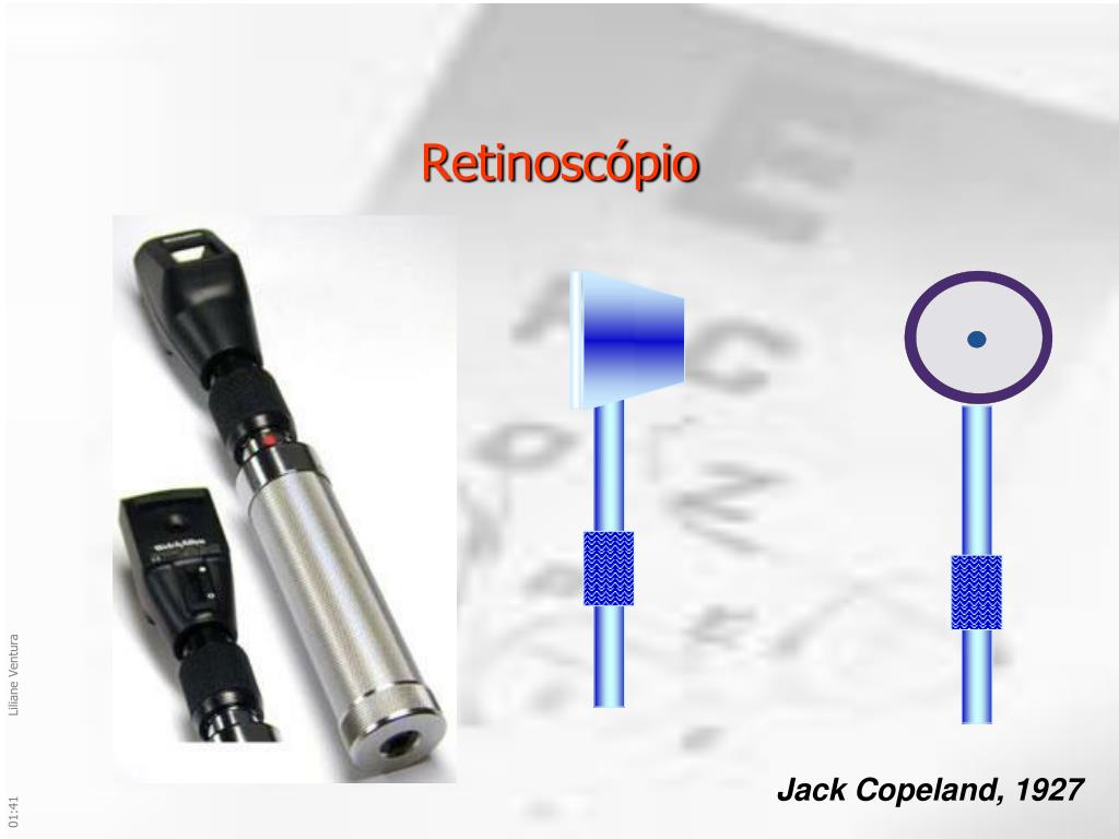 PPT - Princípio s da Retinoscopia e Função de Correção dos Vícios de ...