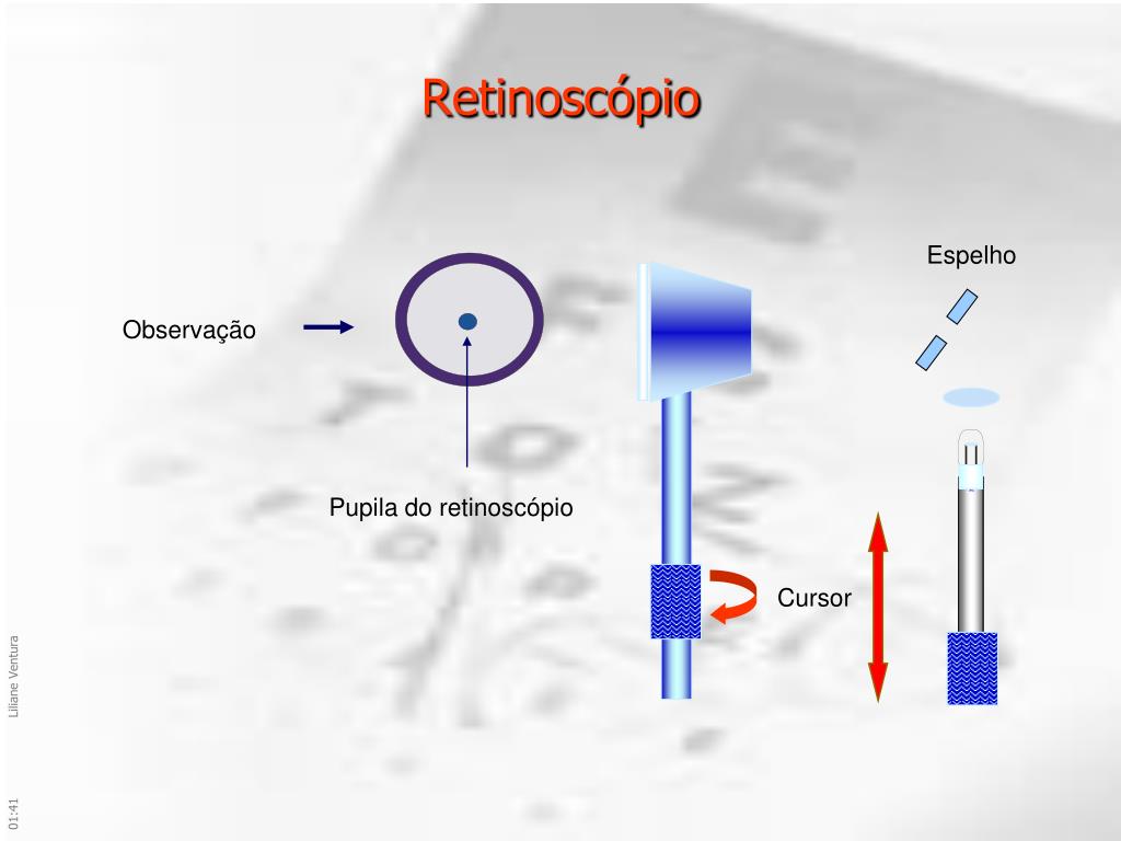 PPT - Princípio s da Retinoscopia e Função de Correção dos Vícios de ...