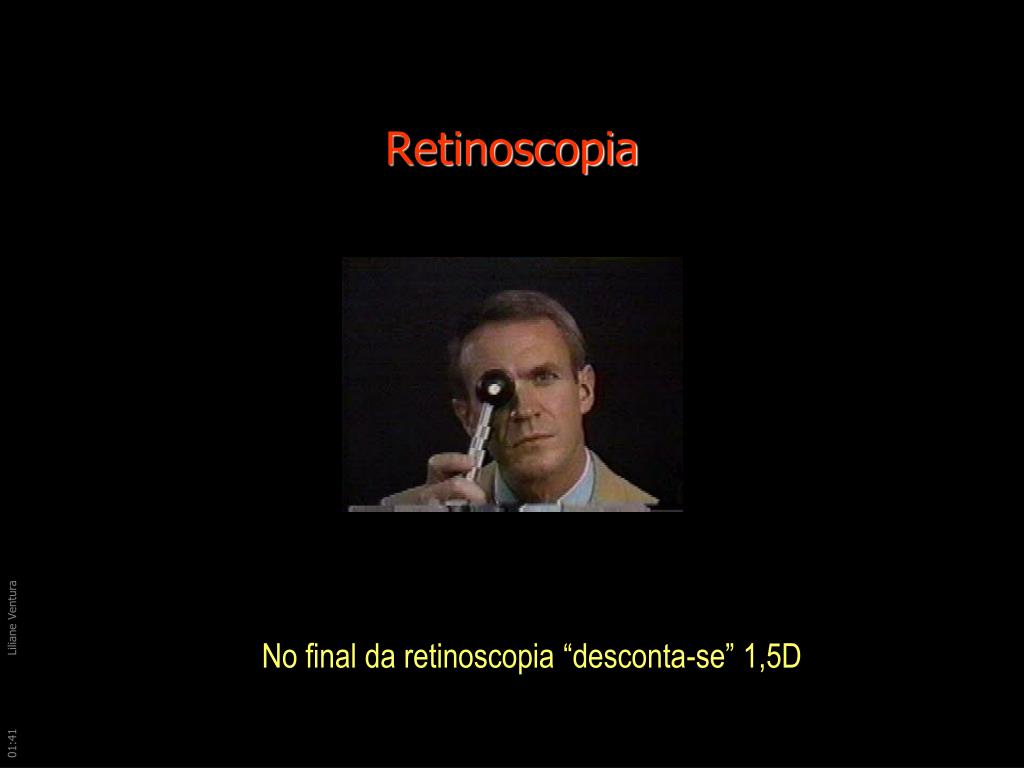 PPT - Princípio s da Retinoscopia e Função de Correção dos Vícios de ...