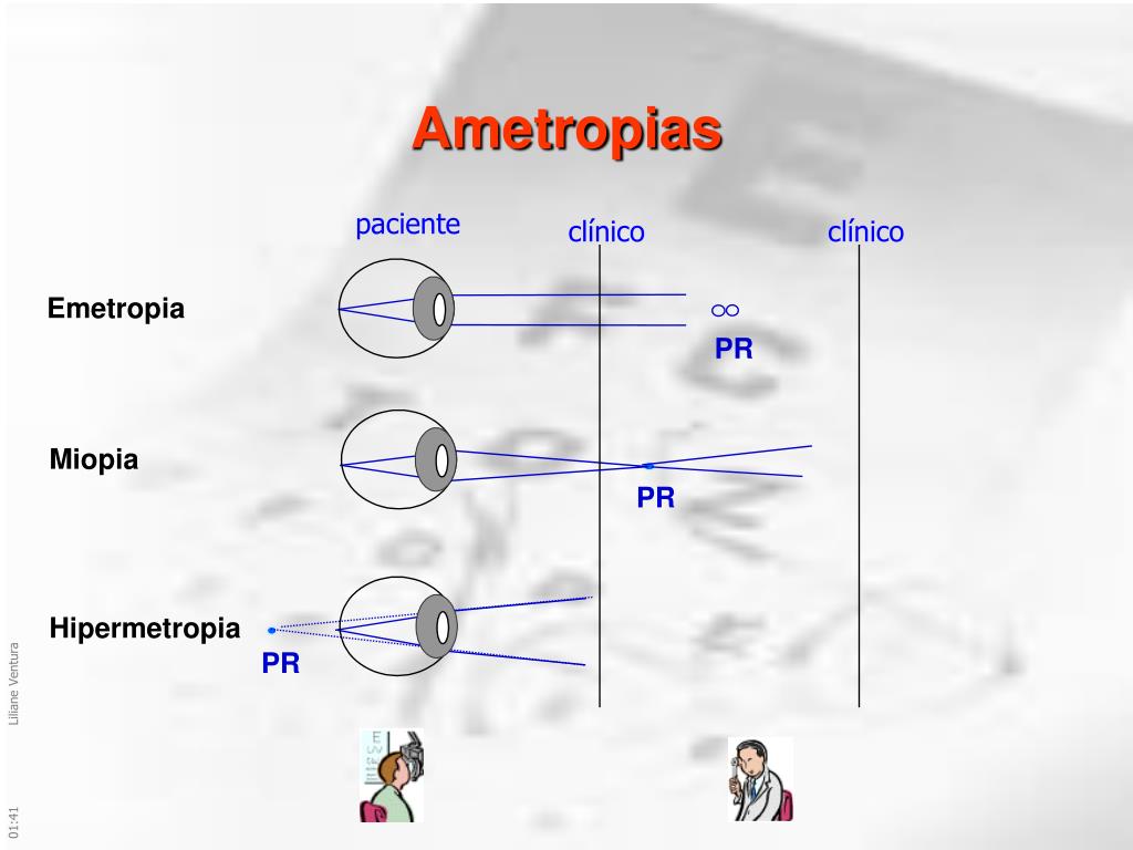 PPT - Princípio s da Retinoscopia e Função de Correção dos Vícios de ...