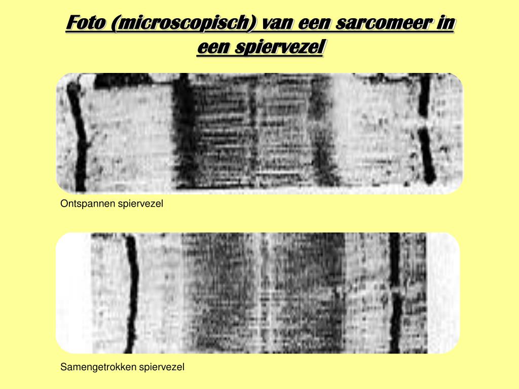 PPT - Spier- of gewrichtspijn, waarom ? PowerPoint Presentation, free ...