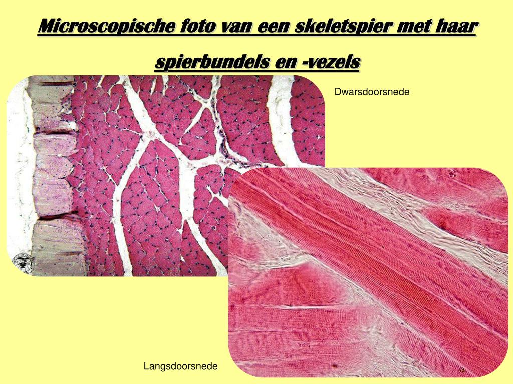 PPT - Spier- of gewrichtspijn, waarom ? PowerPoint Presentation, free ...