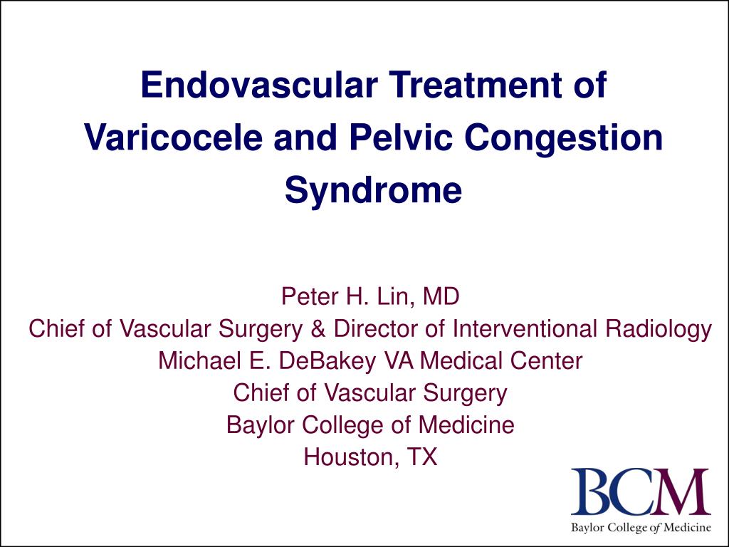 Ppt Endovascular Treatment Of Varicocele And Pelvic Congestion