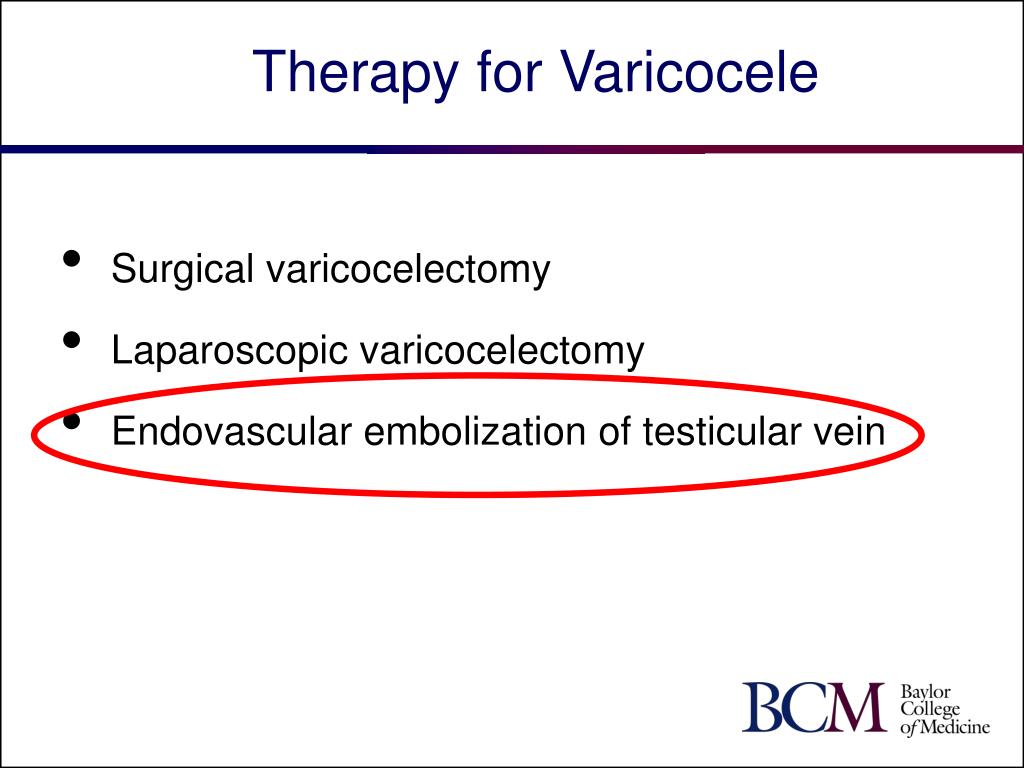 Ppt Endovascular Treatment Of Varicocele And Pelvic Congestion