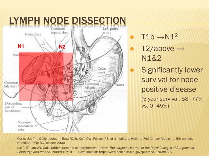 PPT - Management of Gallbladder Carcinoma PowerPoint Presentation - ID ...