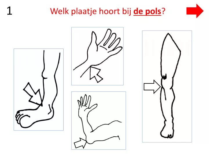 PPT - Welk plaatje hoort bij de pols ? PowerPoint Presentation, free ...