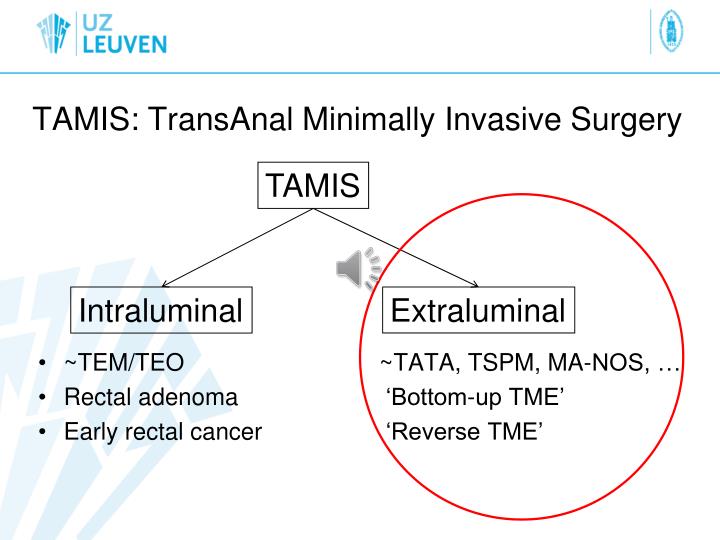 PPT - Transanal Rectal Excision: Video Demonstration Of A TAMIS ...