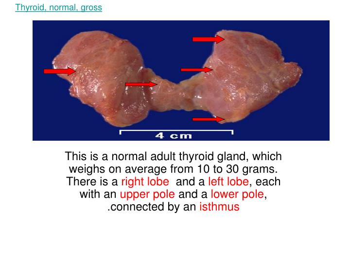 PPT - Thyroid, normal, in situ, gross PowerPoint Presentation - ID:4986996