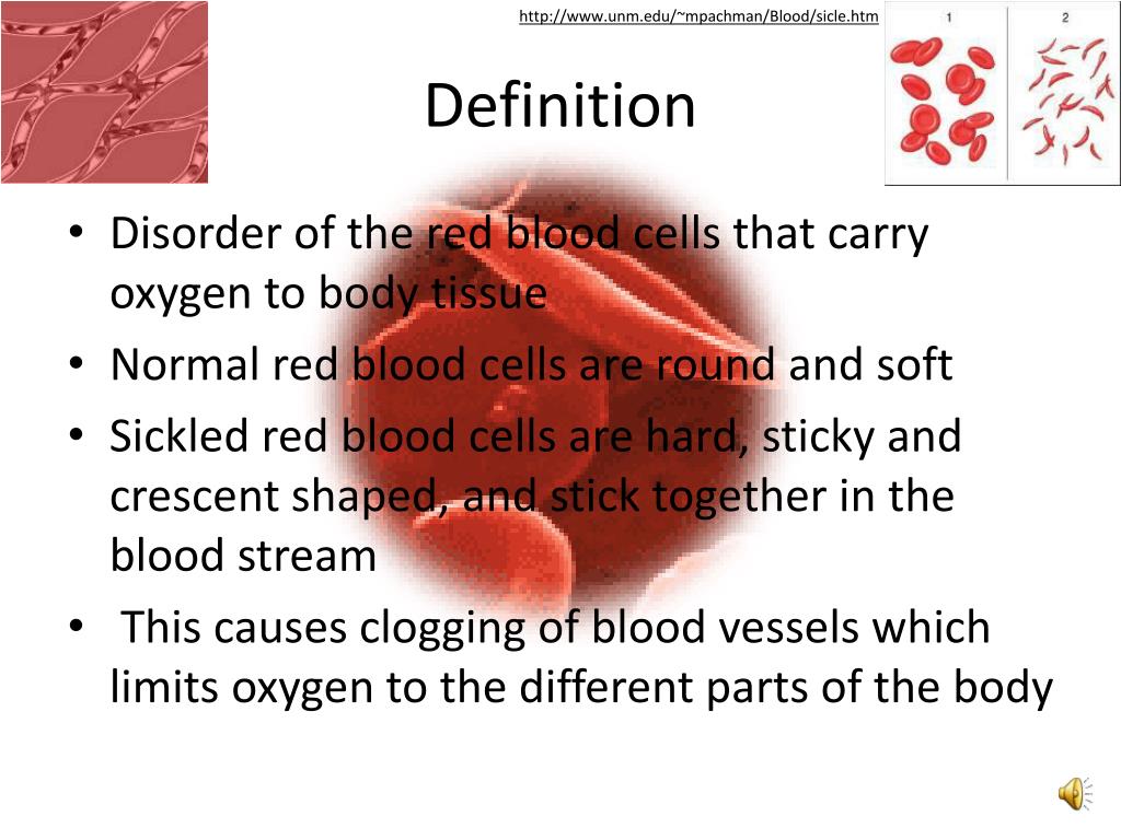 PPT Sickle Cell Disease PowerPoint Presentation Free Download ID 