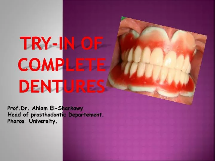 PPT - TRY-IN of COMPLETE DENTURES PowerPoint Presentation - ID:4997759