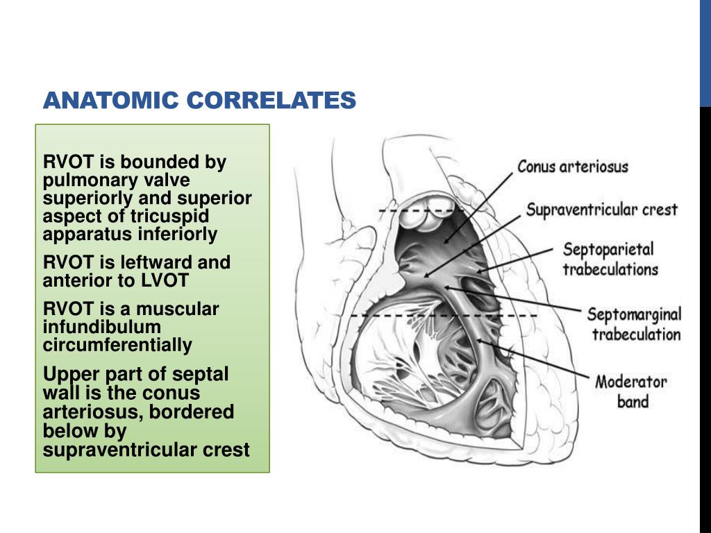 Supraventricular Crest