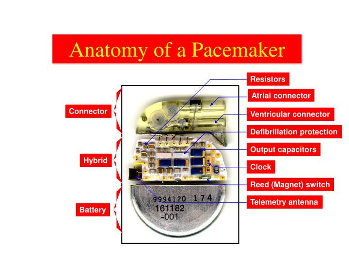PPT - BASICS OF PACEMAKER PowerPoint Presentation - ID:5007873