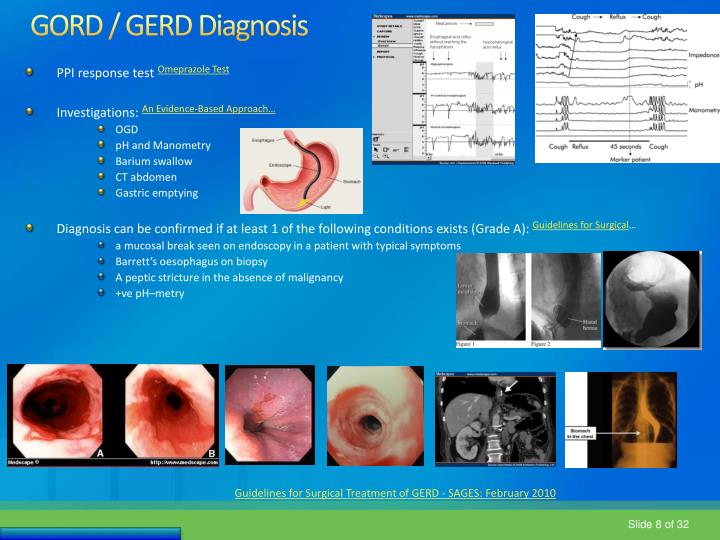 PPT - GORD, Barrett's and Hiatus Hernia PowerPoint Presentation - ID ...