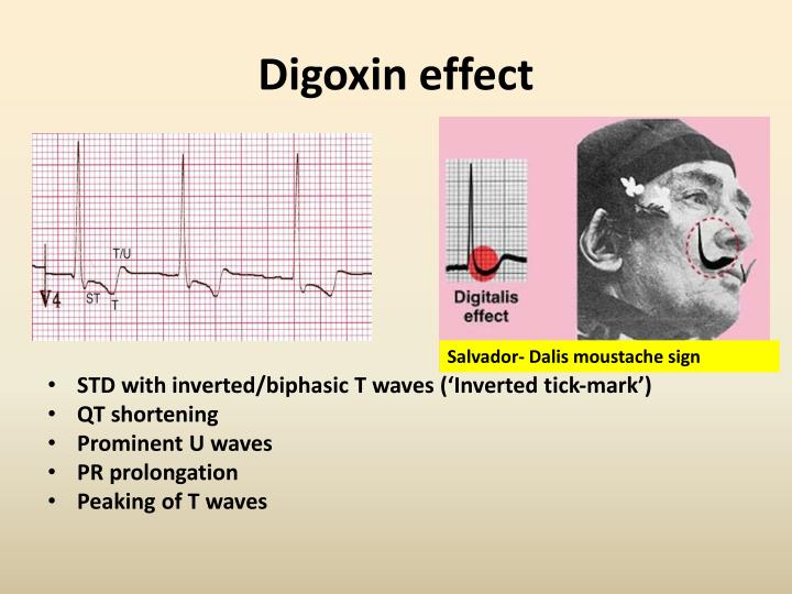 PPT - CARDIAC INOTROPES PowerPoint Presentation - ID:5013599