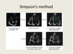 PPT - EVALUATION OF SYSTOLIC FUNCTION OF LEFT VENTRICLE BY ...