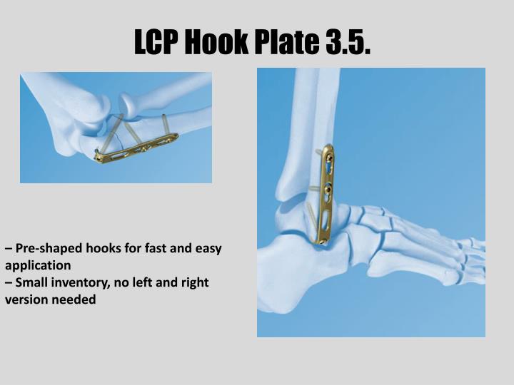 PPT - LCP Olecranon Plates 3.5 PowerPoint Presentation - ID:5031093