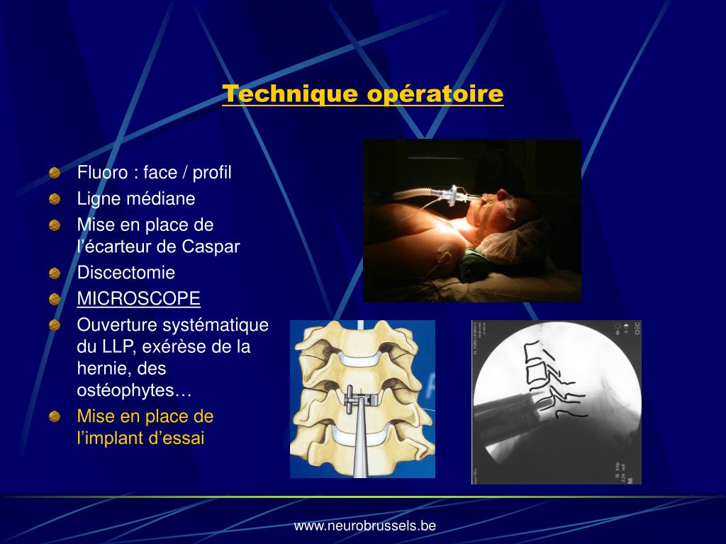 PPT - Dr Patrick Fransen Clinique du Parc Léopold Bruxelles , Belgique ...