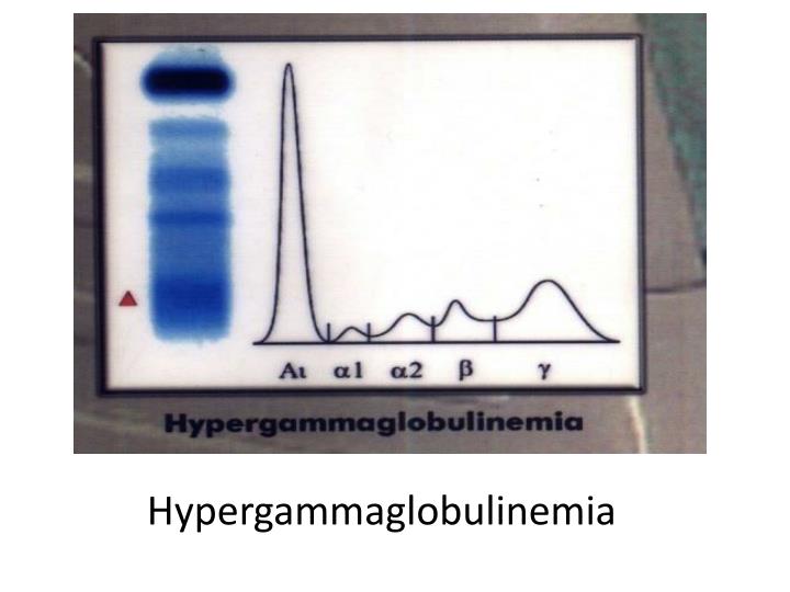 PPT - Serum Electrophoresis AND IMMUNOFIXATION june 2013 PowerPoint ...