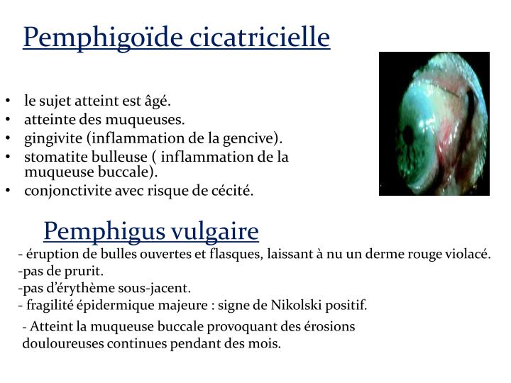 PPT - DERMATOSE BULLEUSE PowerPoint Presentation - ID:5051067