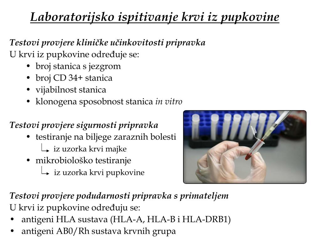 PPT - Organizacija Nacionalne banke krvi iz pupkovine PowerPoint Presentation - ID:5060896