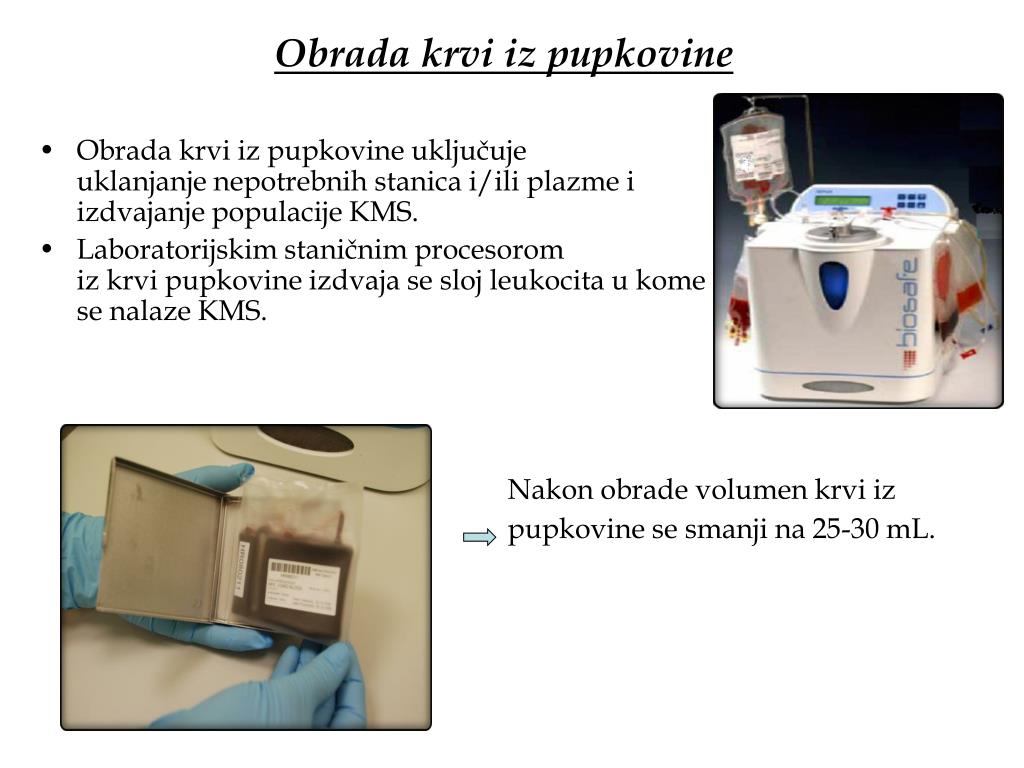 PPT - Organizacija Nacionalne banke krvi iz pupkovine PowerPoint Presentation - ID:5060896