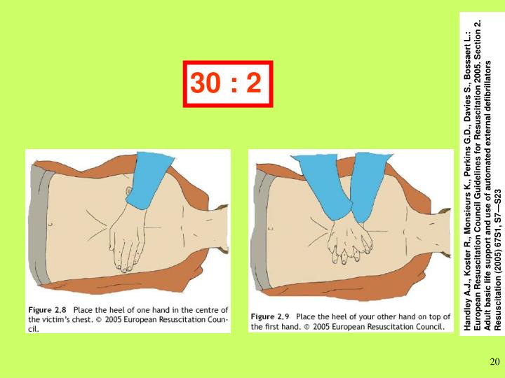 PPT - Kardiopulmonálna resuscitácia dospelých. BLS 2011 PowerPoint ...