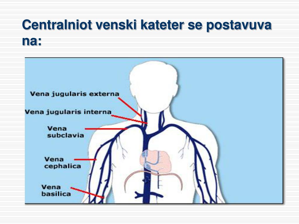 PPT - ПАРЕНТЕРАЛНА ISHRANA KAJ PACIENTITE VO EDINICITE ZA INTENZIVNO ...