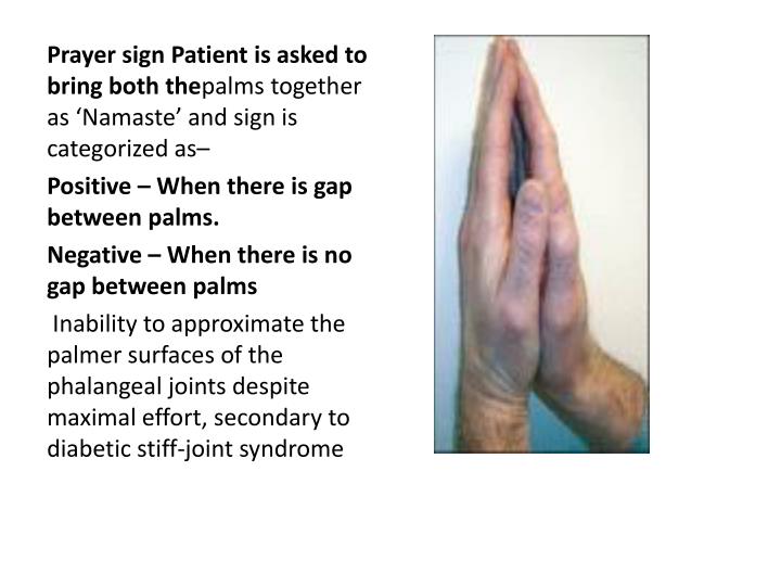 PPT - Anesthetic implications of diabetes mellitus PowerPoint ...