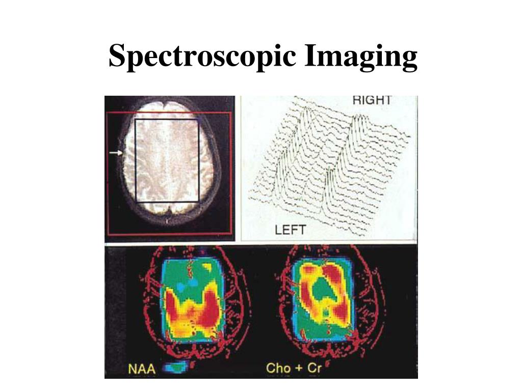 PPT - MR spektroszkópia PowerPoint Presentation, free download - ID:5078850