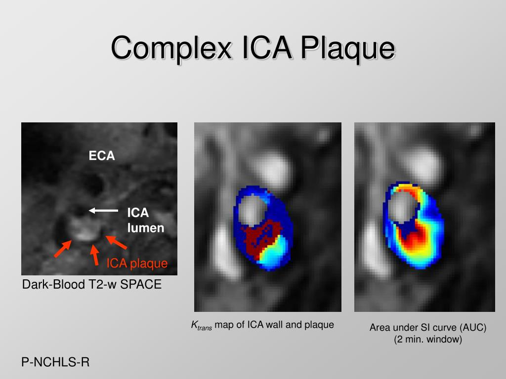 PPT - Lawrence L. Wald, Ph.D. MGH Martinos Center for Biomedical ...