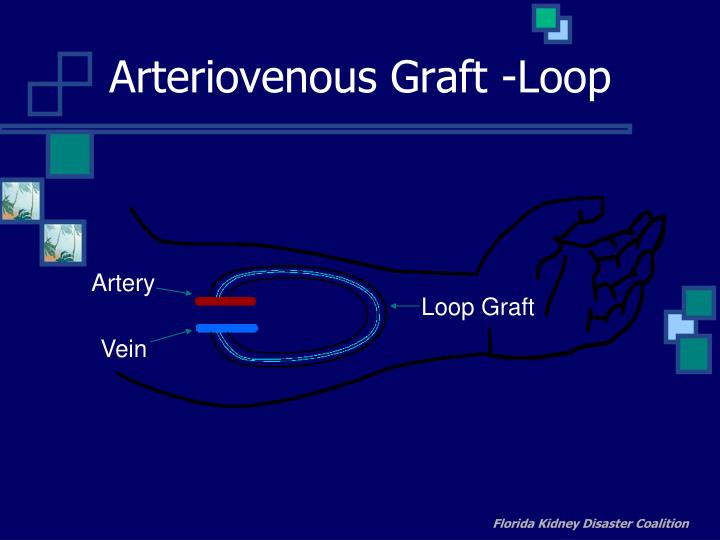 PPT - Chronic Renal Failure Patients PowerPoint Presentation - ID:5086169