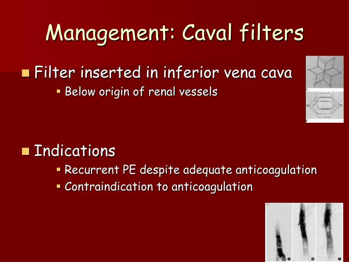 PPT - Pulmonary embolism PowerPoint Presentation - ID:5093146