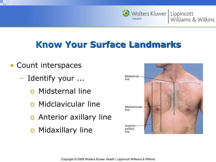 PPT - Chapter 9 The Cardiovascular System PowerPoint Presentation - ID ...