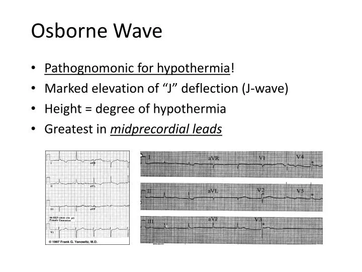 PPT - Osborne Wave PowerPoint Presentation, free download - ID:5096566