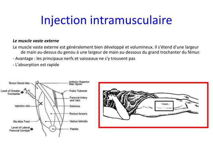 PPT - Les injections intramusculaire (I/m) PowerPoint Presentation - ID ...