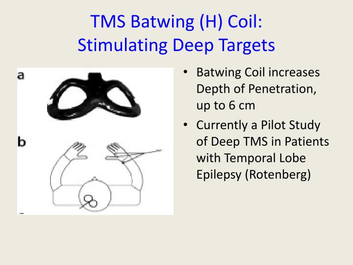 PPT - Stimulating the Brain in Epilepsy PowerPoint Presentation - ID ...