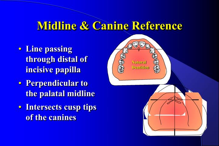 PPT - Selecting Denture Teeth PowerPoint Presentation - ID:5108717