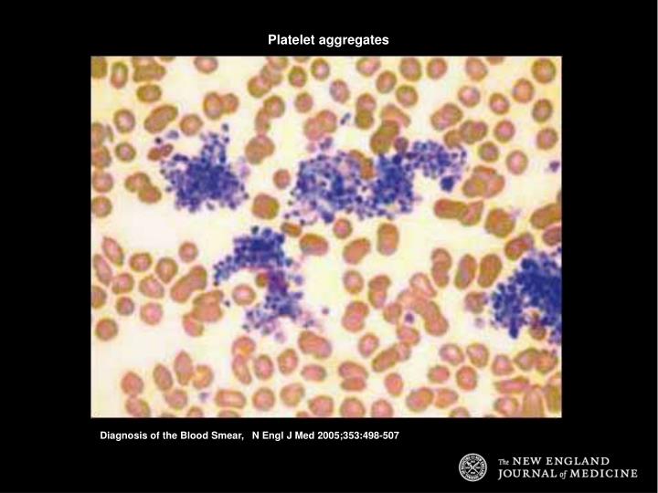 PPT - Diagnosis of the Blood Smear, N Engl J Med 2005;353:498-507 ...