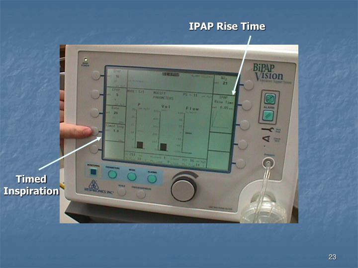 PPT - Respironics BiPAP- Vision PowerPoint Presentation - ID:5127374