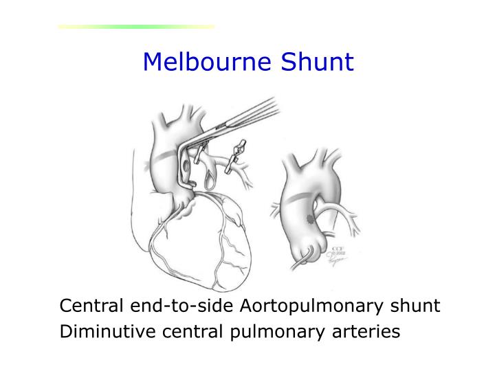 PPT - Surgical Treatment of PA with VSD without/with MAPCA PowerPoint ...