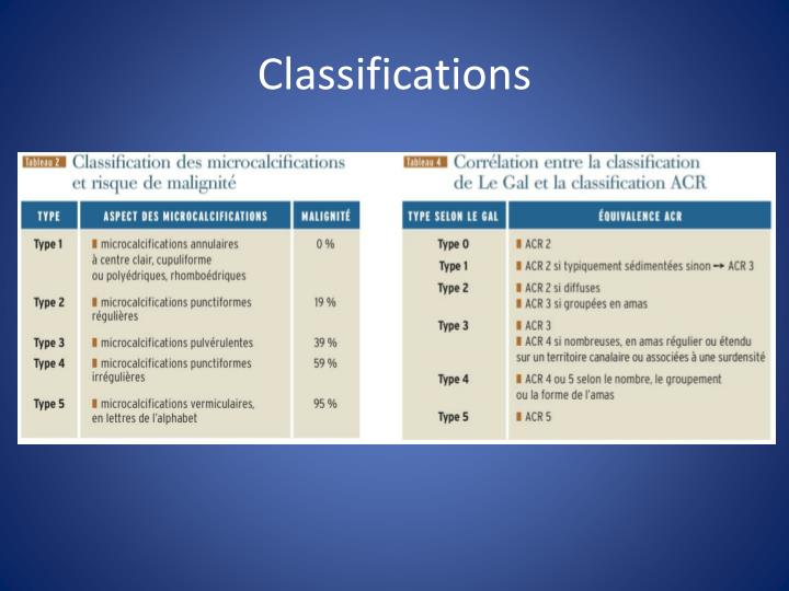 PPT - Tumeurs du sein PowerPoint Presentation - ID:5133697