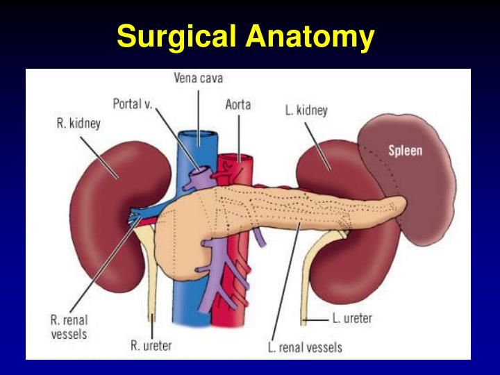 PPT - ACUTE PANCREATITIS PowerPoint Presentation - ID:5135787