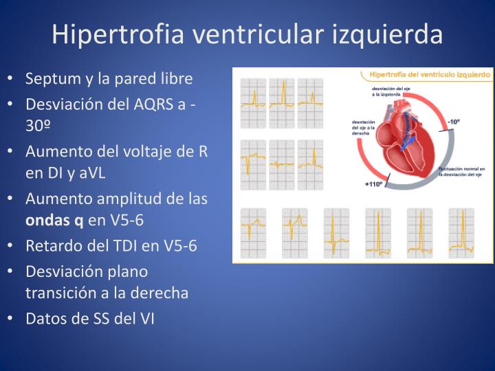 PPT - Curso de Electrocardiografía Patológico PowerPoint Presentation ...