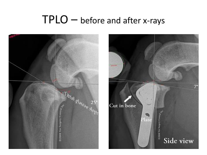 PPT - CCL/ACL Injuries PowerPoint Presentation - ID:5139807