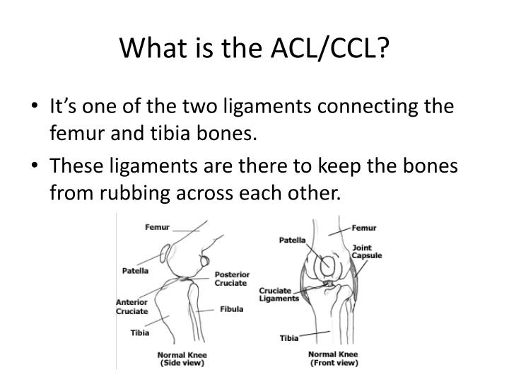 PPT - CCL/ACL Injuries PowerPoint Presentation - ID:5139807