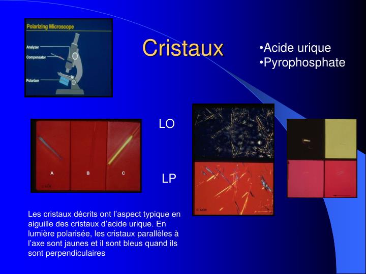 PPT - Prise en charge d’une arthrite aiguë PowerPoint Presentation - ID ...