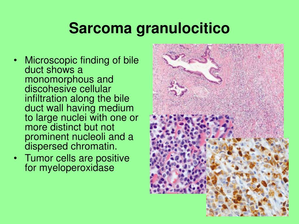 PPT - TUMORI RARI DEL DISTRETTO EPATO-BILIARE PowerPoint Presentation ...