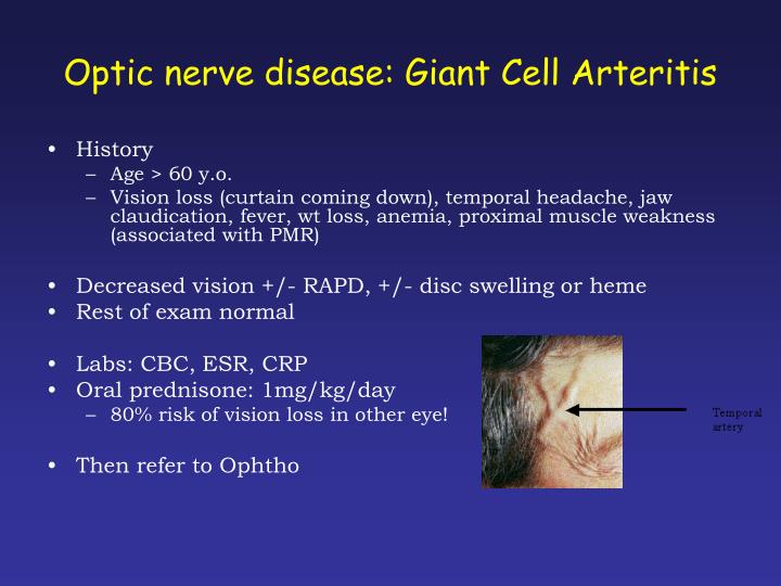 PPT - Back to Basics Ophthalmology: Acute visual disturbance/loss ...